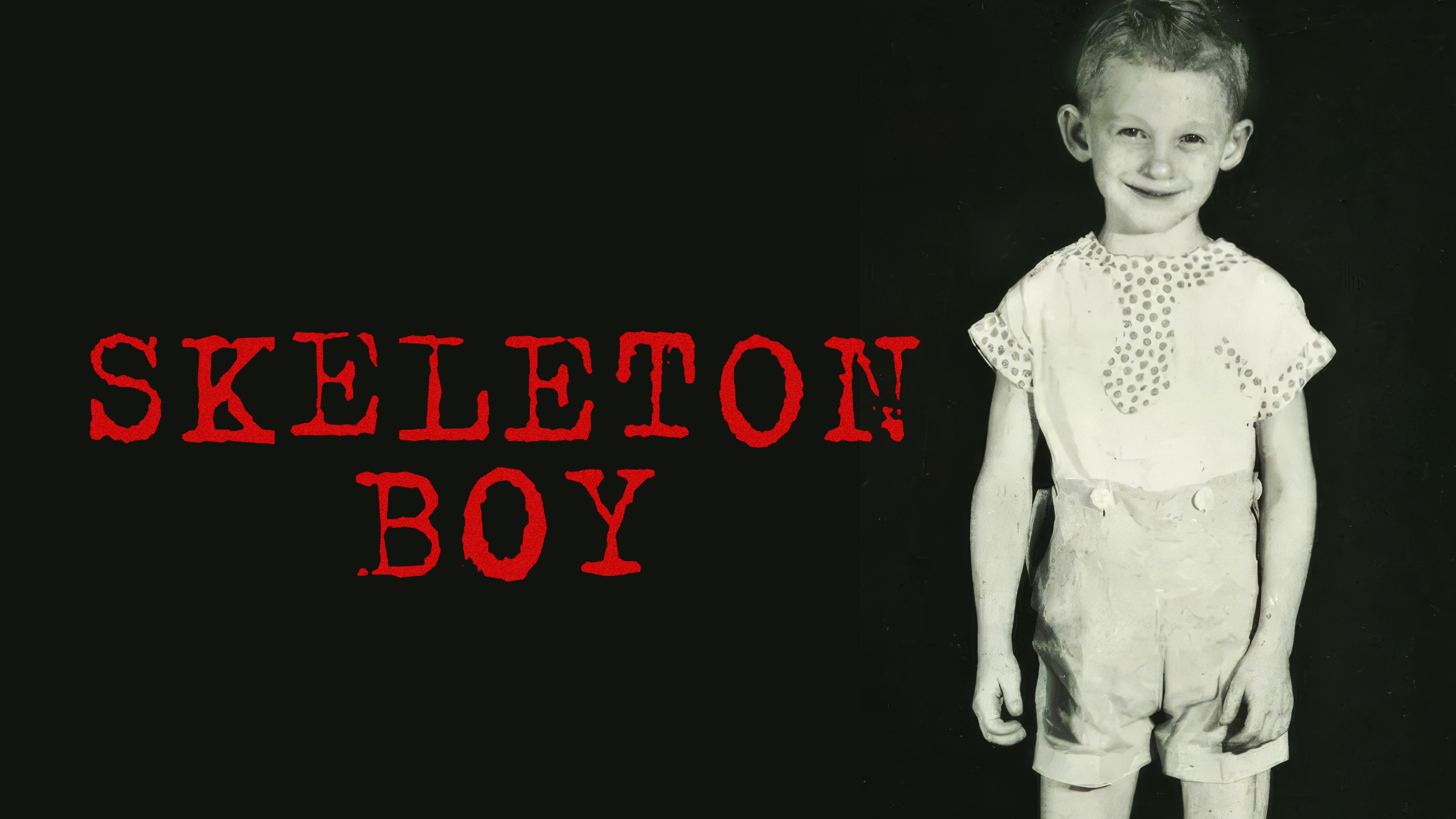 Skeleton Boy | Documentary Channel